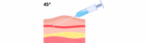 Injections sous-cutanée et Intramusculaire - Ide Fiches