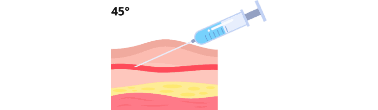 Injections sous-cutanée et Intramusculaire - Ide Fiches